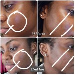 Eucerin Dual Serum Review – sarah fynn