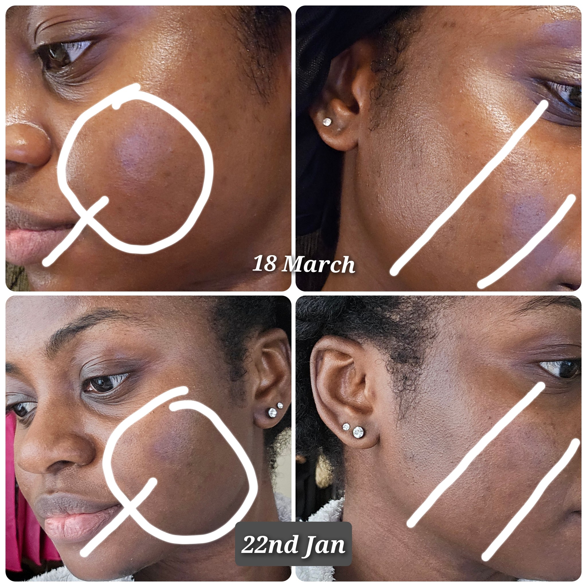 Eucerin Dual Serum Review – sarah fynn